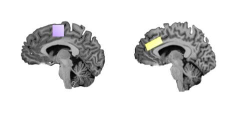 A chemical imbalance discovered in the brain may explain obsessive ...