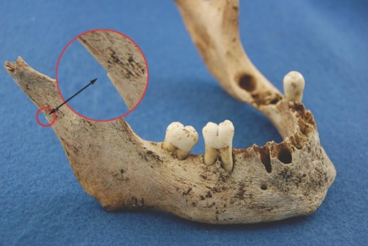 Shocking DNA results suggest crew of doomed 1845 expedition ate their ...