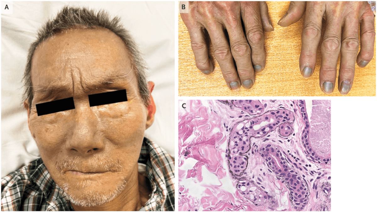 You Are What You Eat: How Food Affects Skin Color